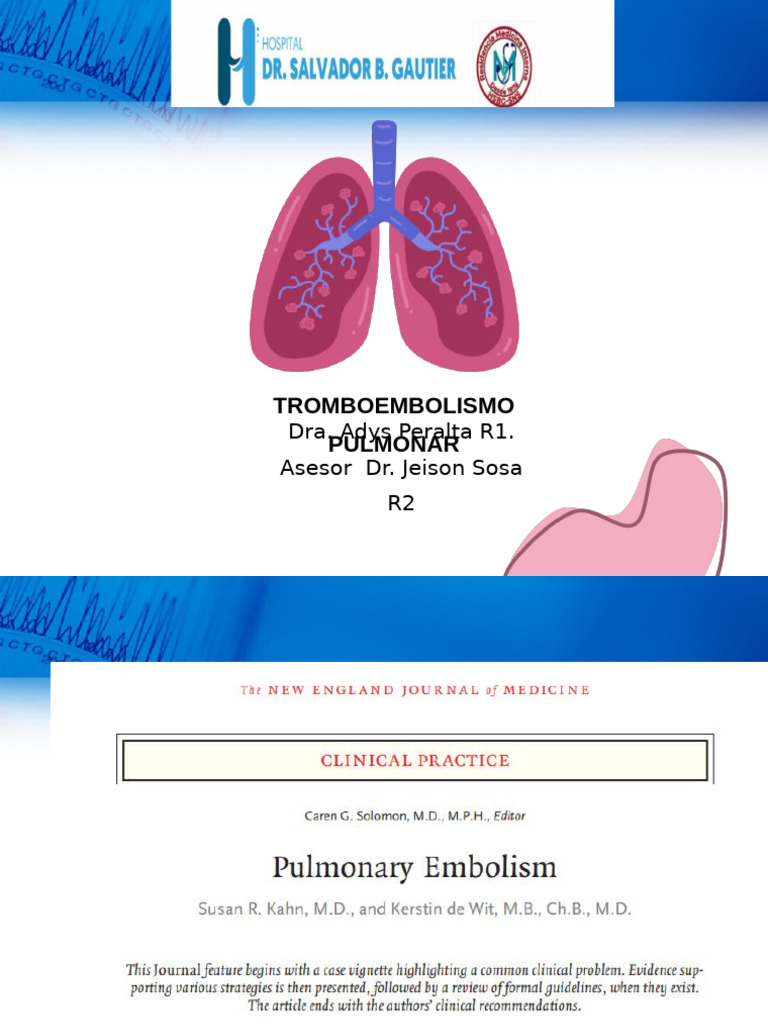 Pulmonary Embolism | PDF | Enfermedades cardiovasculares | Medicina CLINICA