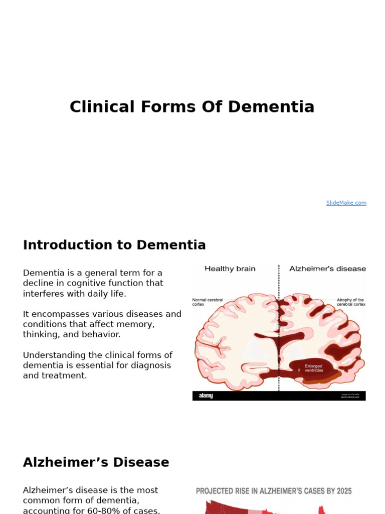 Clinical Forms of Dementia Explained | PDF | Dementia | Alzheimer's Disease