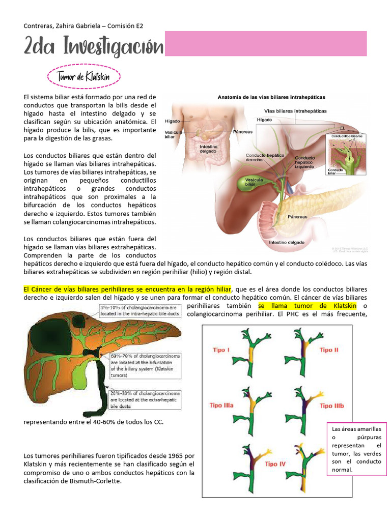 Tumor de Klatskin: Diagnóstico y Tipos | PDF | Bilis | Hígado