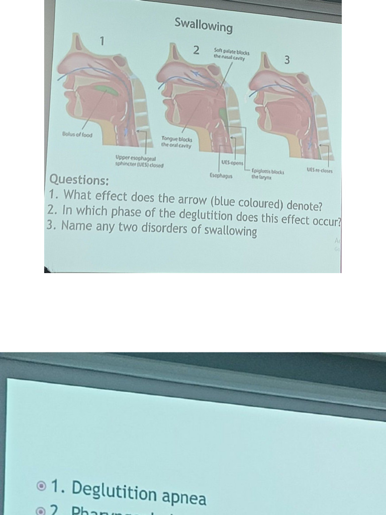 Physiology Ospe(GIT and RS) | PDF