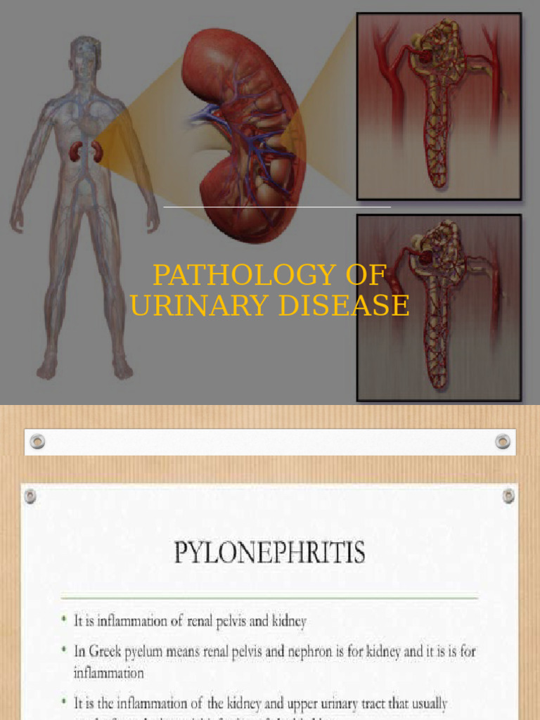 Pathology of Urinary Disease | PDF