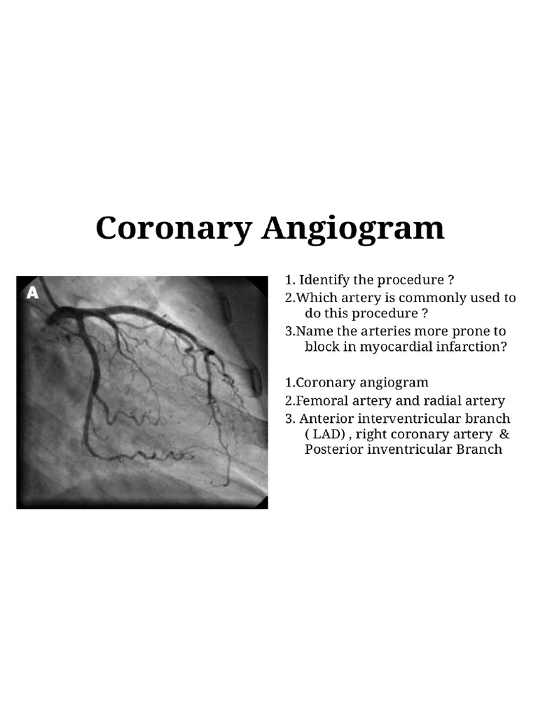 2nd Internals Anatomy Ospe | PDF