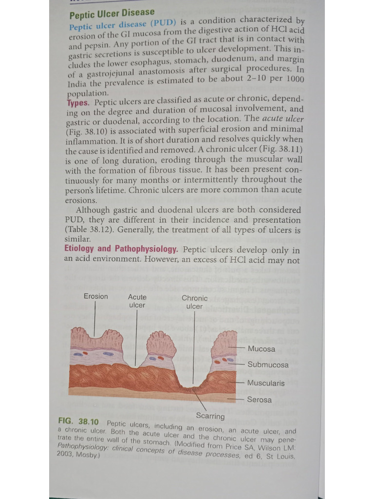 Peptic Ulcer Disease | PDF