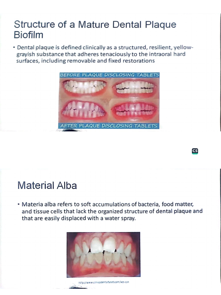 Dental Plaque Biofilm | PDF