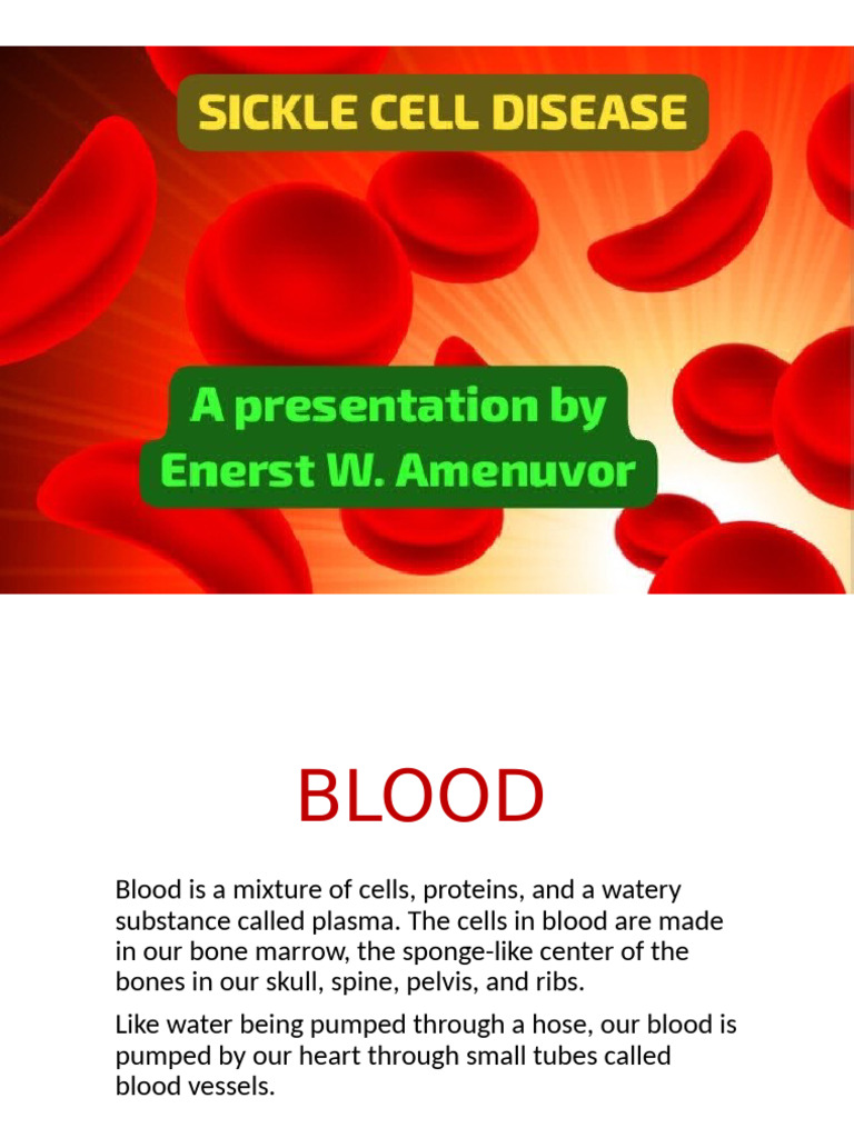 Sickle Cell Presentation | PDF