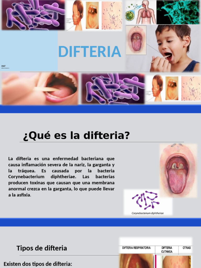 Prevención y síntomas de la difteria | PDF | Microbiología | Salud pública