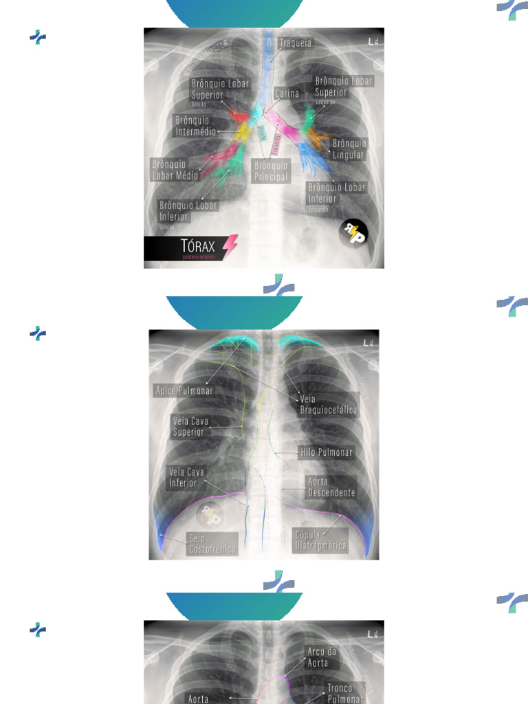 TORÁX | PDF