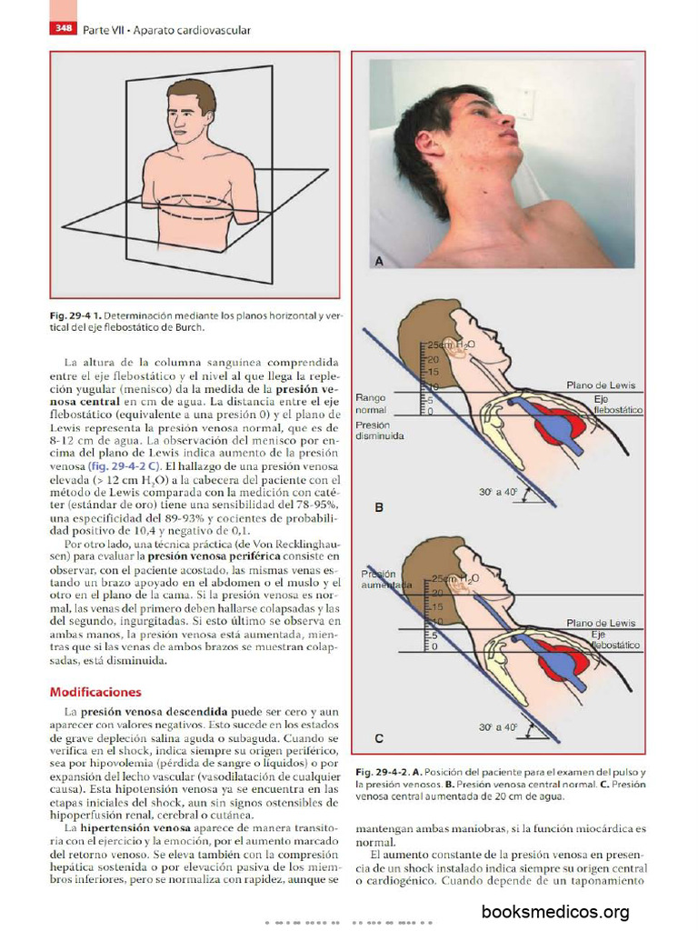 Cap 29-4 Presion y Pulso Venoso | PDF