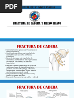 Fracturas de Cotilo: Clasificación y Tratamiento | PDF | Pelvis ...