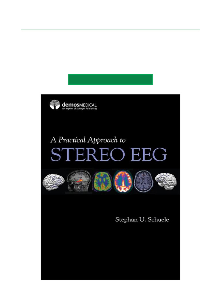 Top Rated A Practical Approach To Stereo EEG, 1st Edition Extended ...