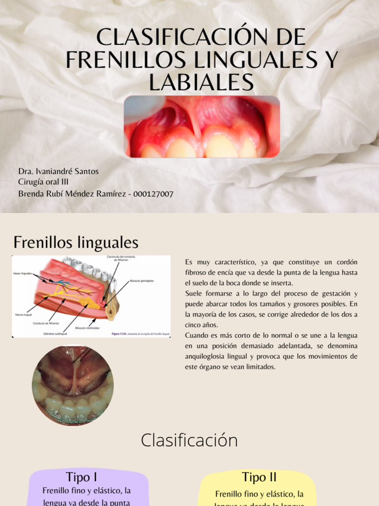 Clasificación de Frenillos Linguales y Labiales | PDF | Lengua | Boca