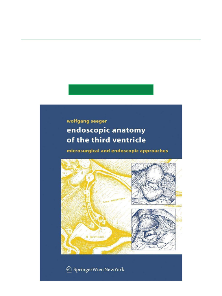 Third Ventricle Endoscopic Anatomy Guide | PDF