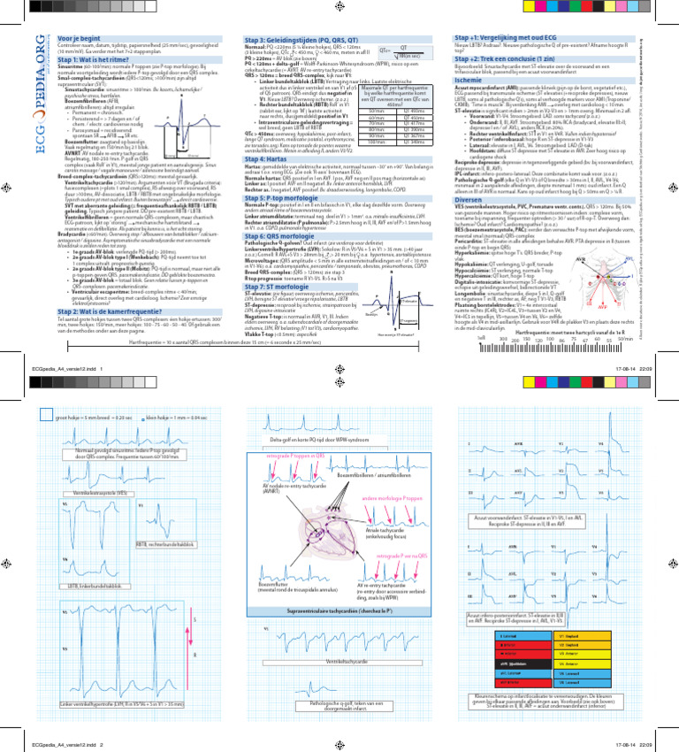 ECG Zakkaart | PDF