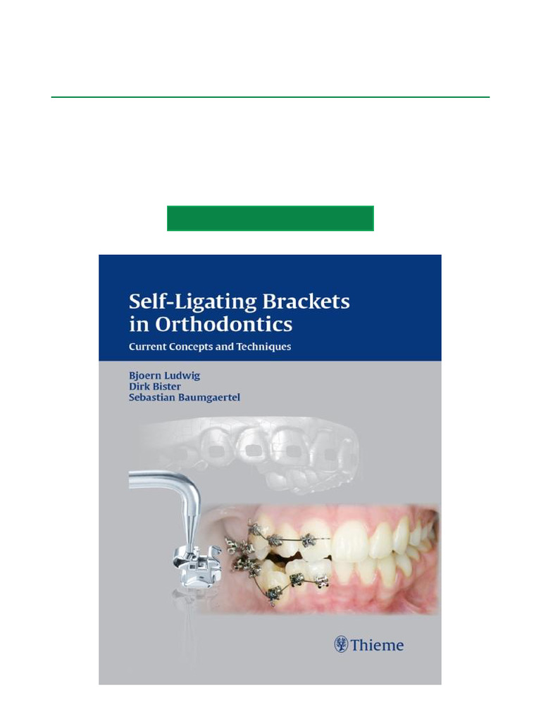 Hardcover Self Ligating Brackets in Orthodontics Current Concepts and ...