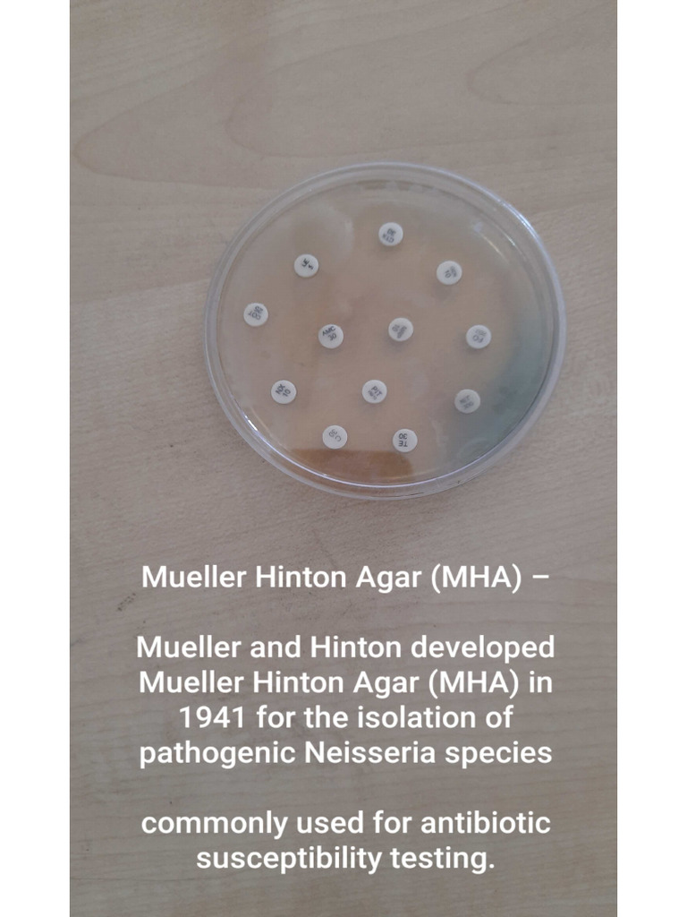 Micro Spotting 10 Marks - JML | PDF