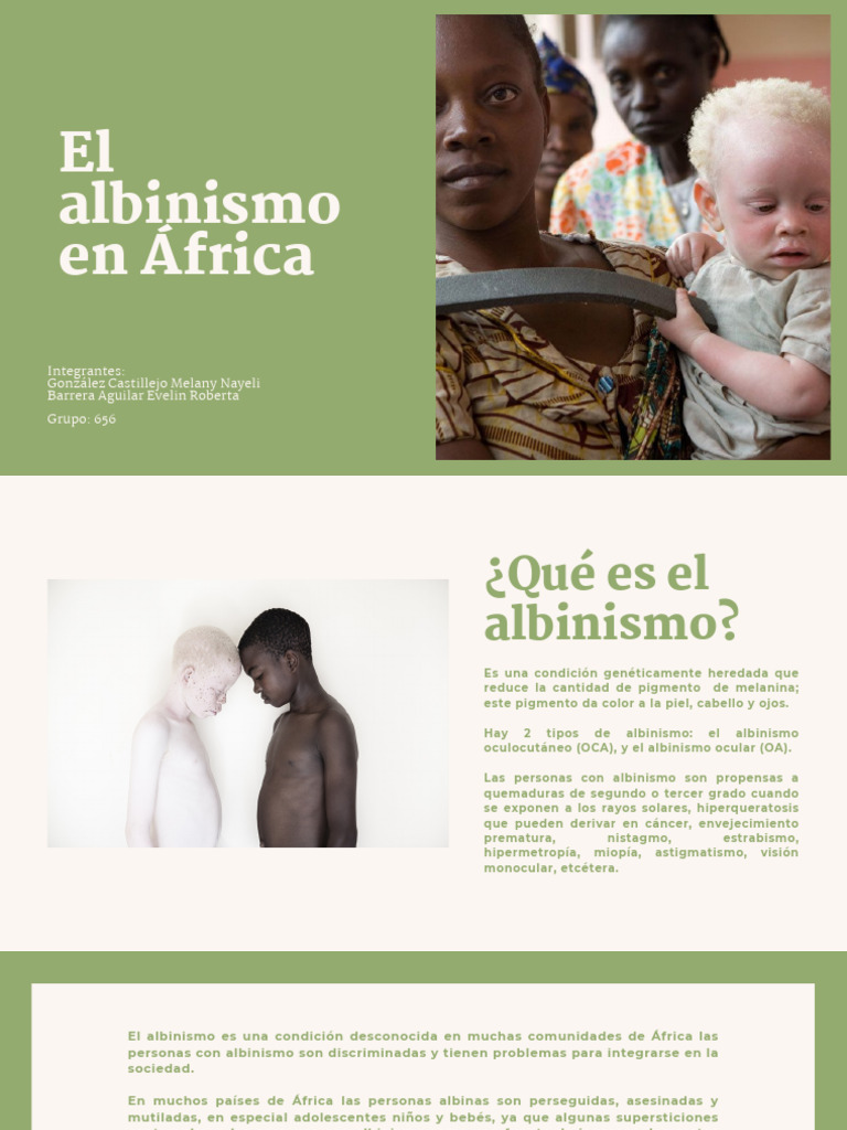 Albinismo en África 656 | PDF | Tirosina | Genética