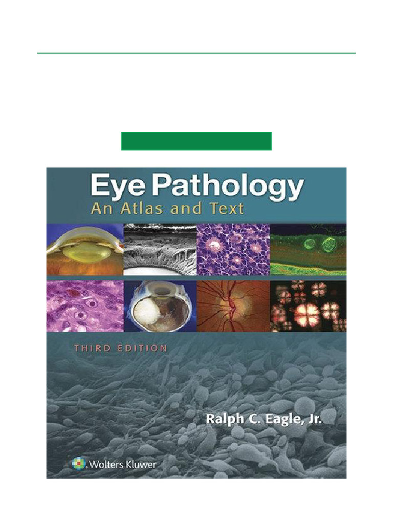 Hurry Download Eye Pathology An Atlas and Text - 3rd Edition Complete ...