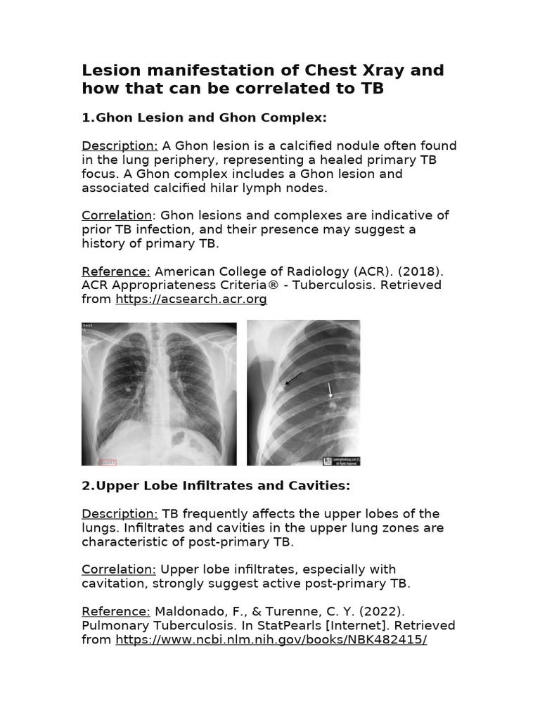 Lesion Manifestation 6th Feb | PDF
