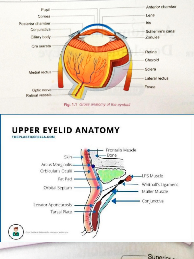 Ophthal Record Diagrams | PDF