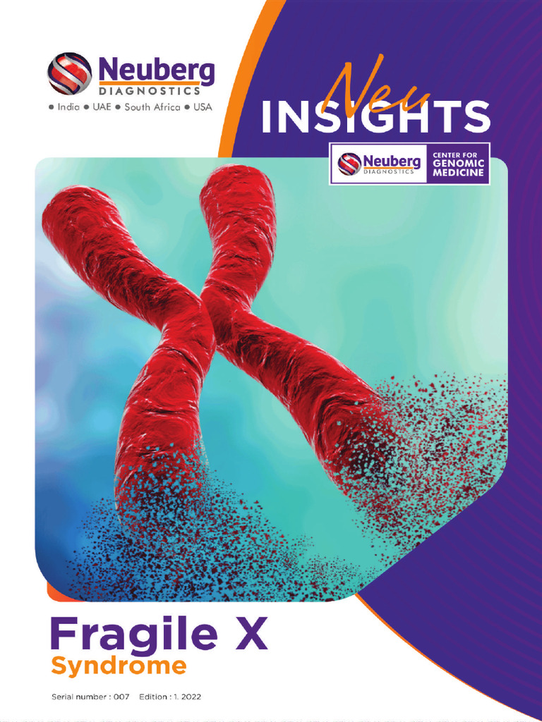 07-Fragile-X-Syndrome_compressed(1) | PDF