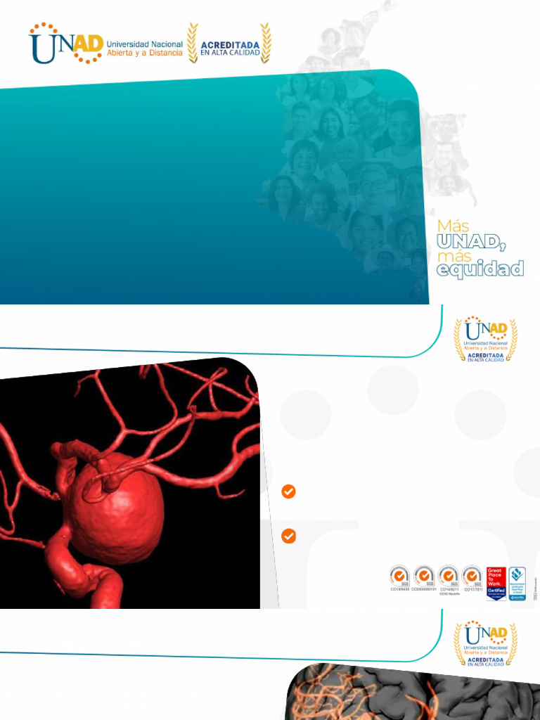 Aneurismas y Malformaciones Vasculares Intracraneales | PDF | Angiografía | Enfermedades vasculares