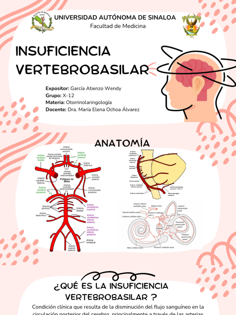 Insuficiencia Vertebrobasilar - PDF 2 | PDF | Isquemia | Aterosclerosis