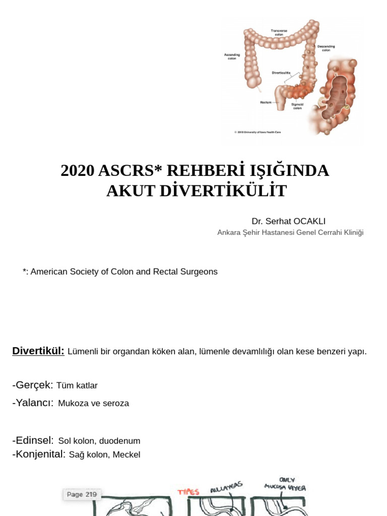 Divertikülit Sunum | PDF