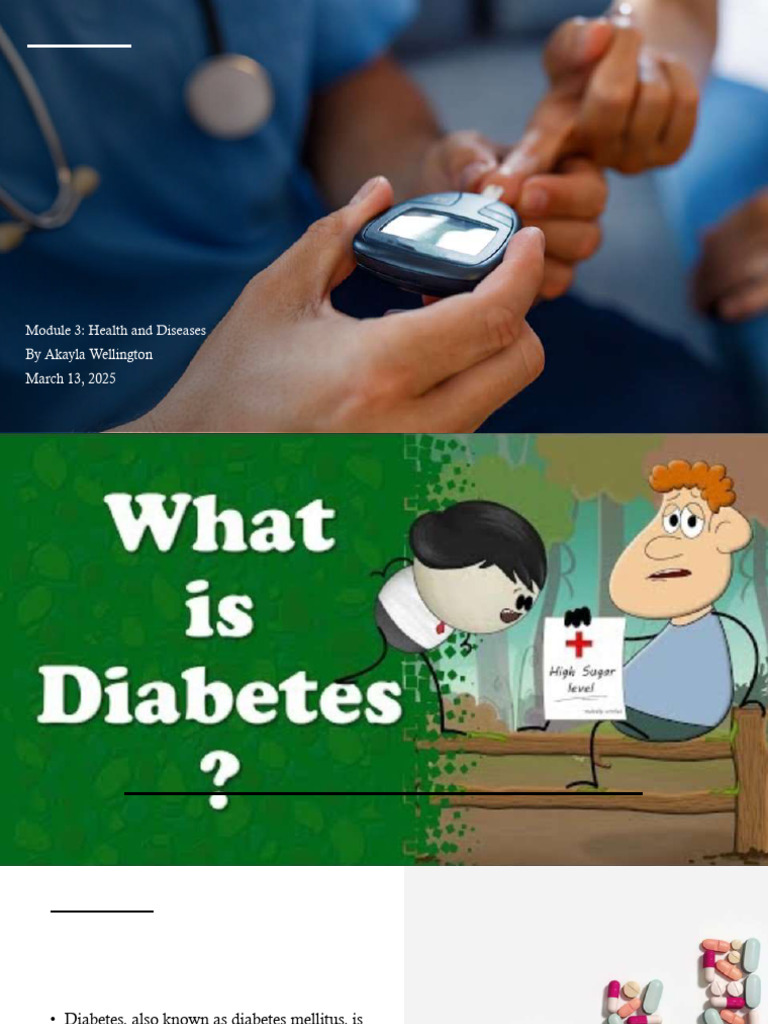 Diabetes mellitus presentation | PDF | Diabetes | Hyperglycemia