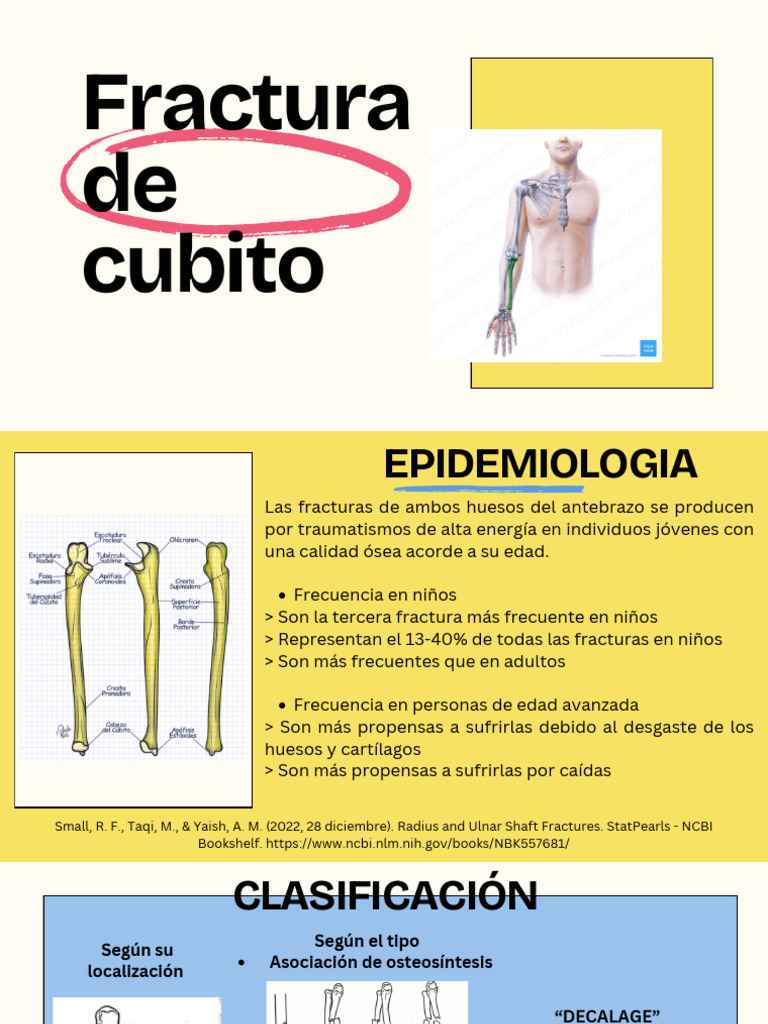 Fractura de Cúbito | PDF | Traumatologia | Codo