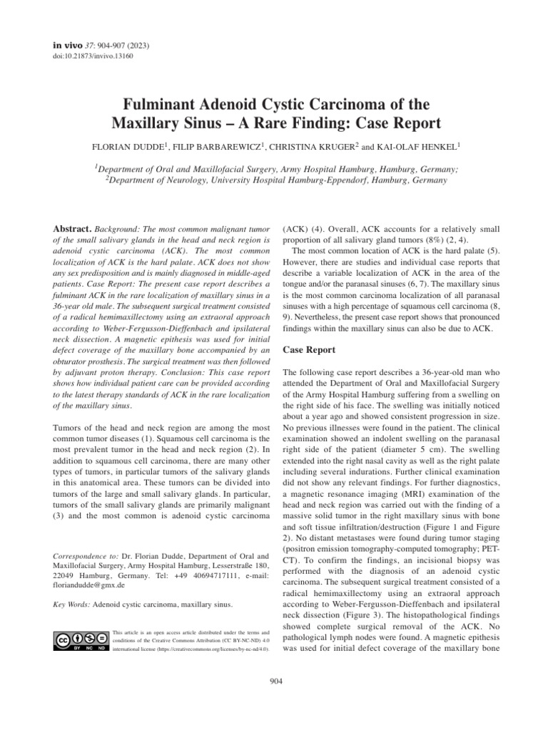 Fulminant Adenoid Cystic Carcinoma of The Maxillary Sinus - A Rare ...