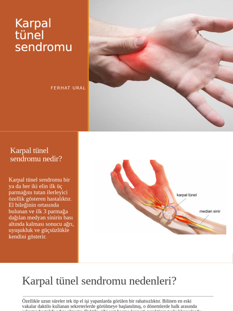 Carpal Tünel Sendromu | PDF