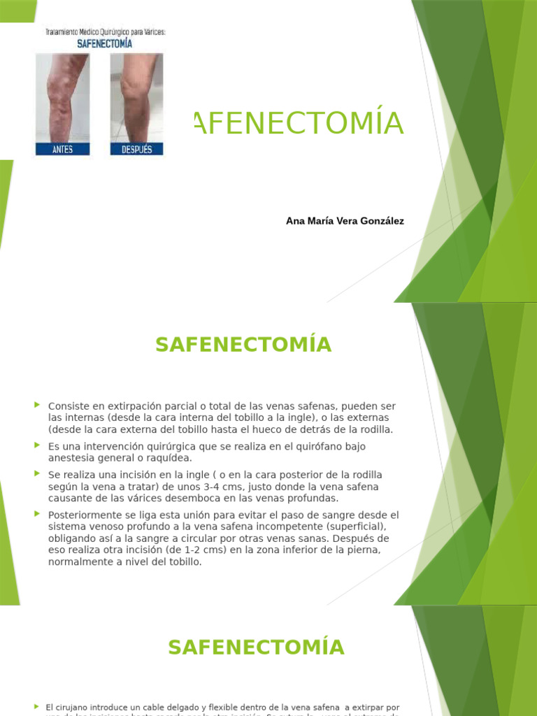 SAFENECTOMÍA | PDF | Venas varicosas | Vena