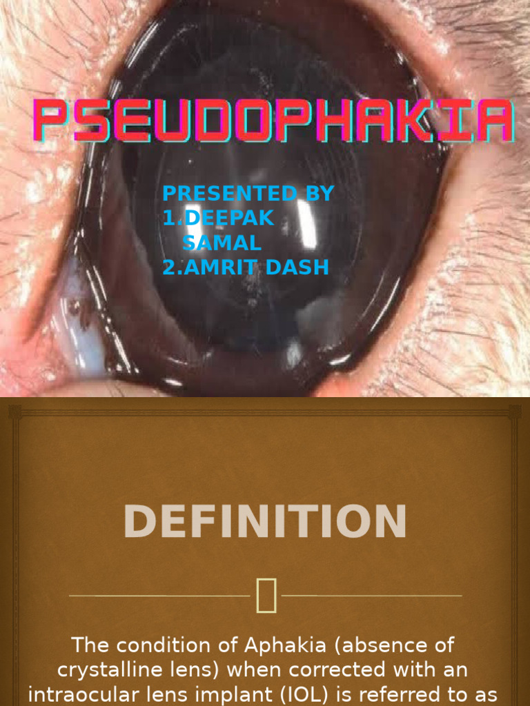 Pseudophakia | PDF