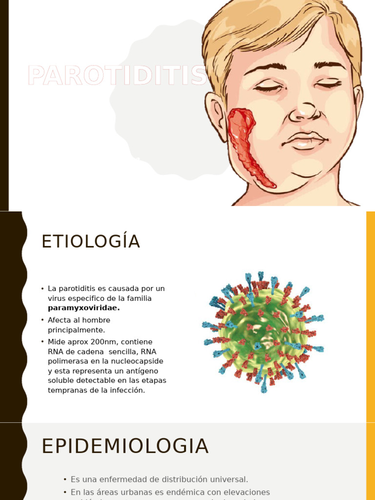 Parotiditis | PDF | Inmunología | Enfermedades y trastornos humanos