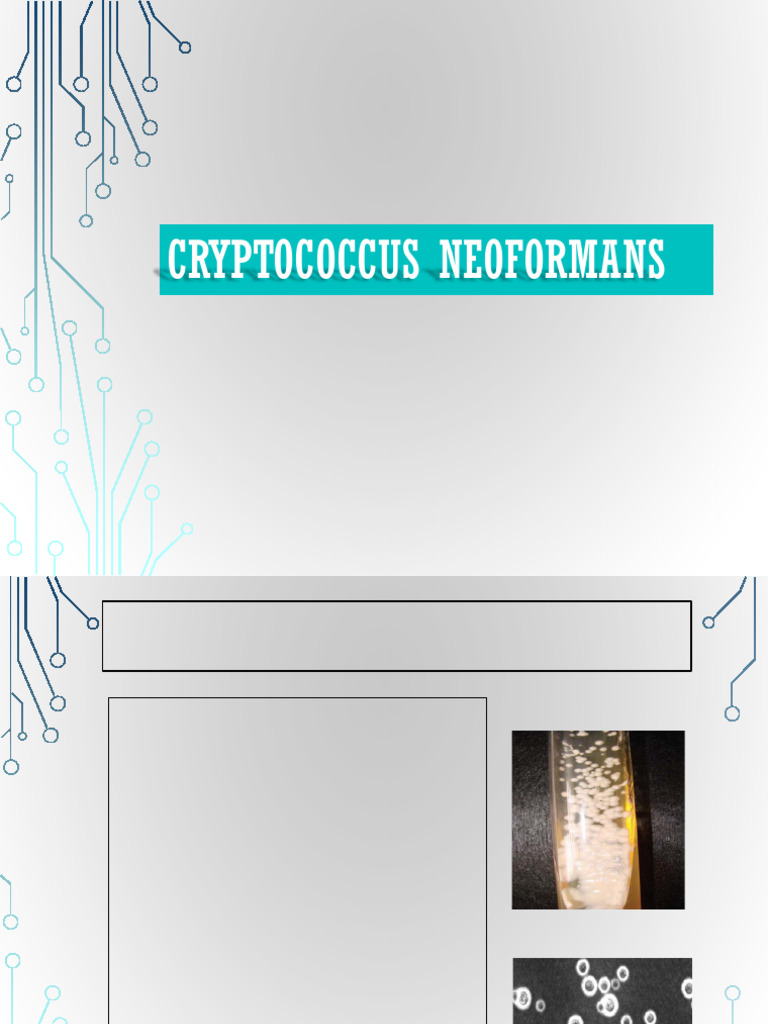 Cryptococcal Meningitis | PDF