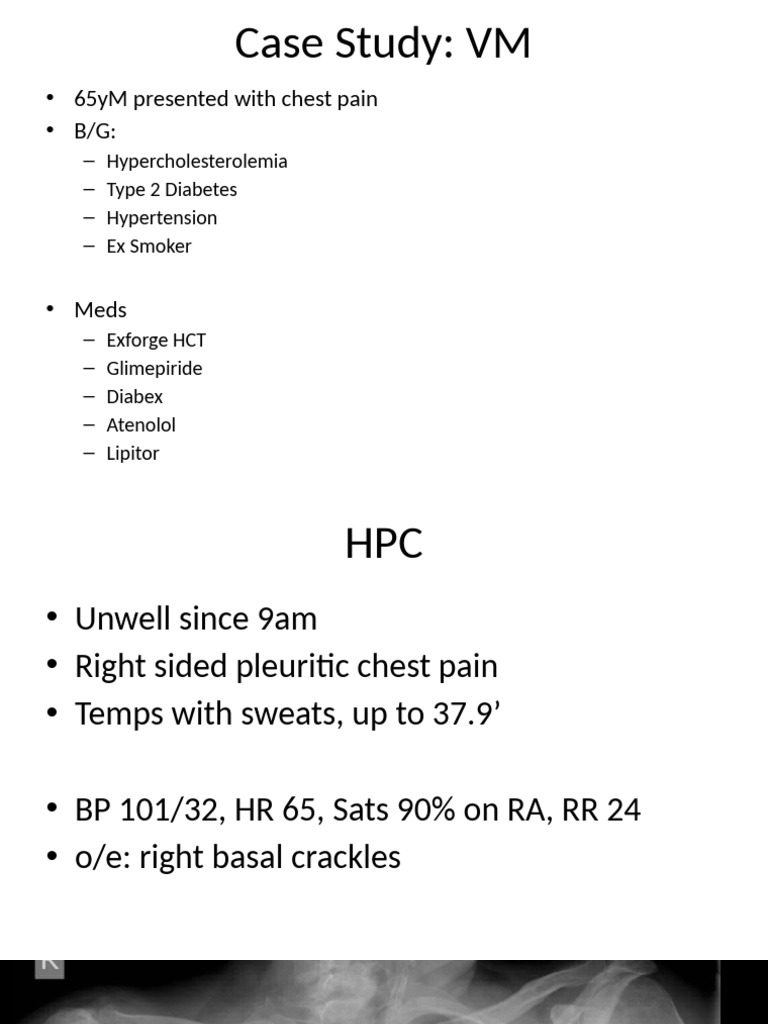 Unilateral Phrenic Palsy | PDF | Sleep Apnea | Thorax