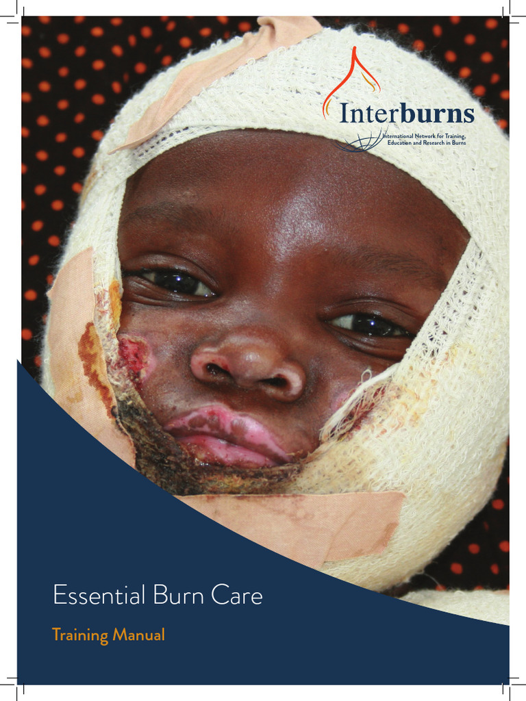 Essential Burn Care Training Manual | PDF | Wound | Burn