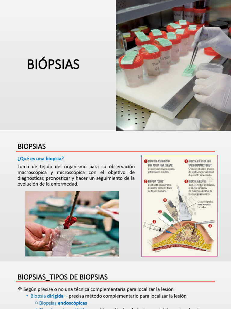 Tipos y Técnicas de Biopsias Médicas | PDF | Biopsia | Neoplasias