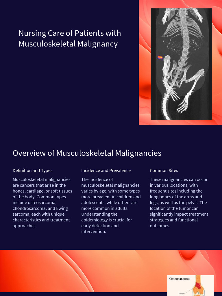Musculoskeletal Malignancy | PDF | Cancer | Surgery