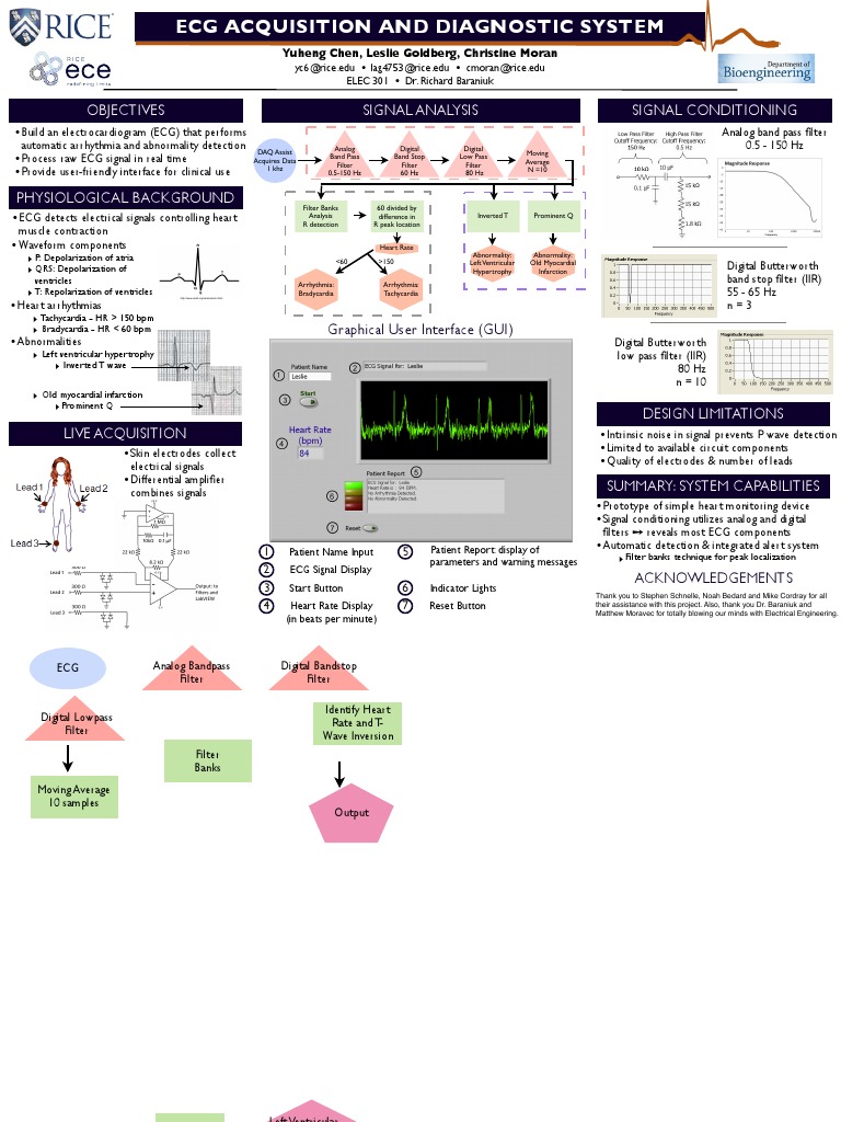 Elec301-Final Poster Eeeeeeeee | PDF | Electrocardiography | Cardiac ...