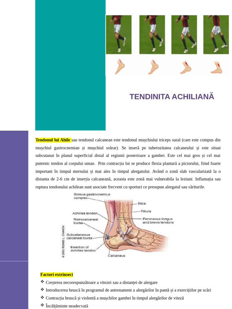 Tendinita Achiliană | PDF