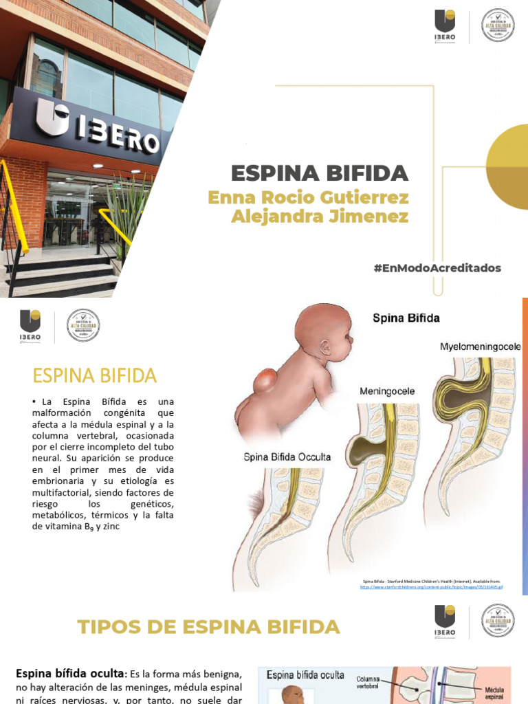 Espina Bifida Nrc-2744 | PDF | Especialidades Medicas | Sistema nervioso