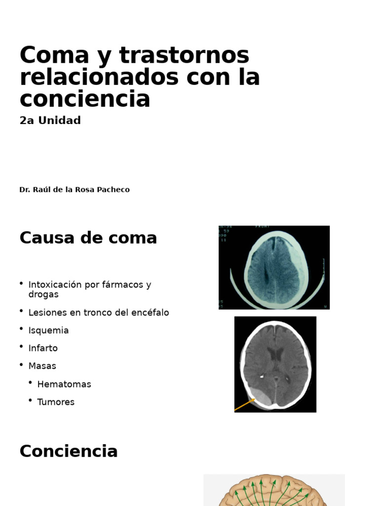 Trastornos relacionados con la conciencia | PDF | Enfermedades y trastornos | Enfermedades y ...