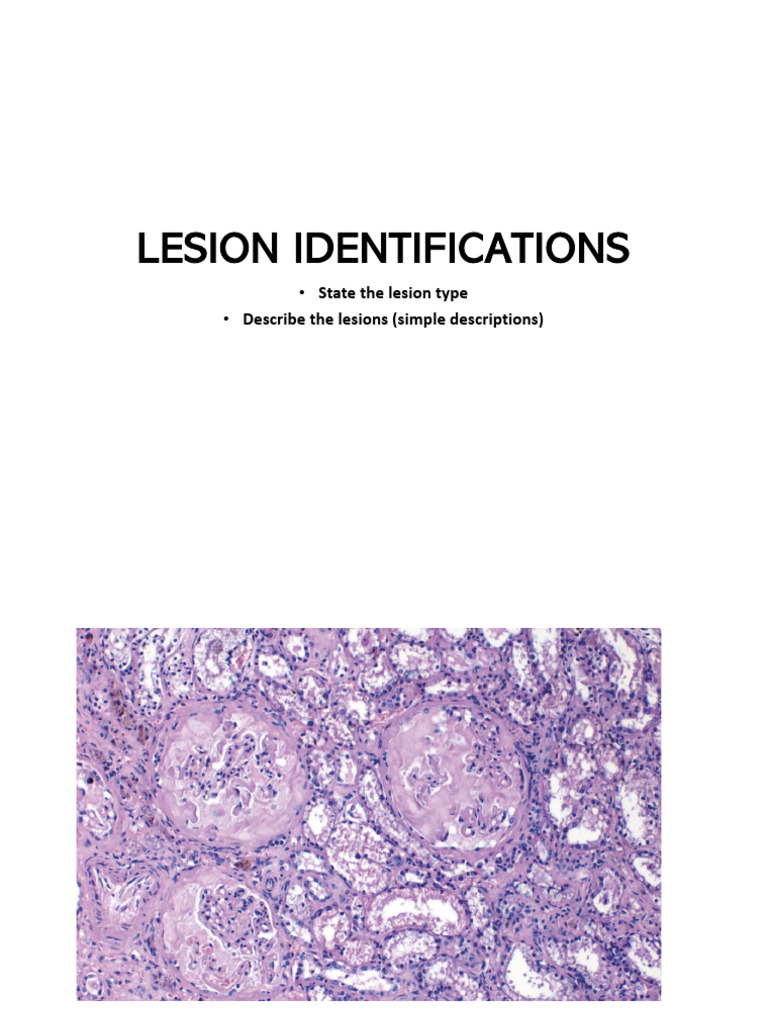 Tutorial Lesions Identifications | PDF