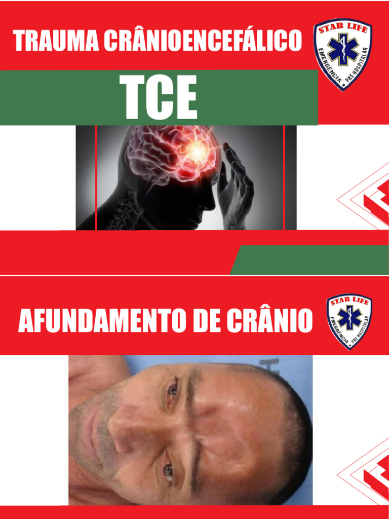 SBV No Trauma - Lesões Específicas TCE | PDF | Traumatismo craniano ...