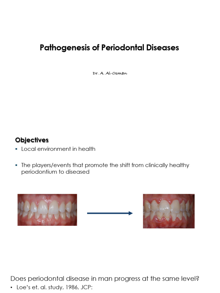 Lesson 8 - PATHOGENESIS OF PERIODONTAL DISEASES | PDF | Periodontology ...