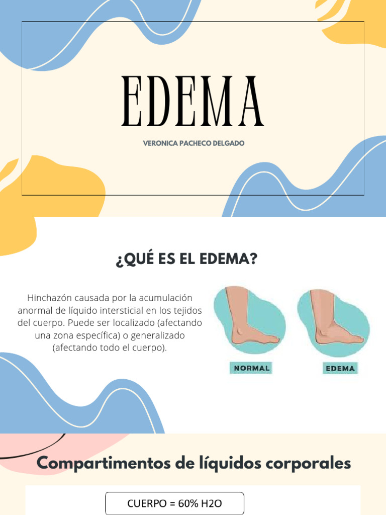 EDEMA | PDF | Edema | Especialidades Medicas