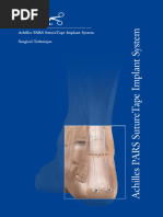 FiberStitch™ Meniscal Repair Technique | PDF | Surgical Suture ...