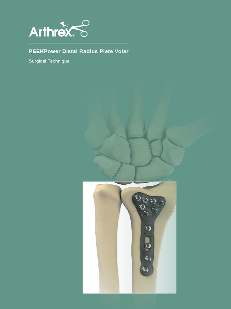 PEEKPower Distal Radius Plate Volar | PDF | Screw | Drill