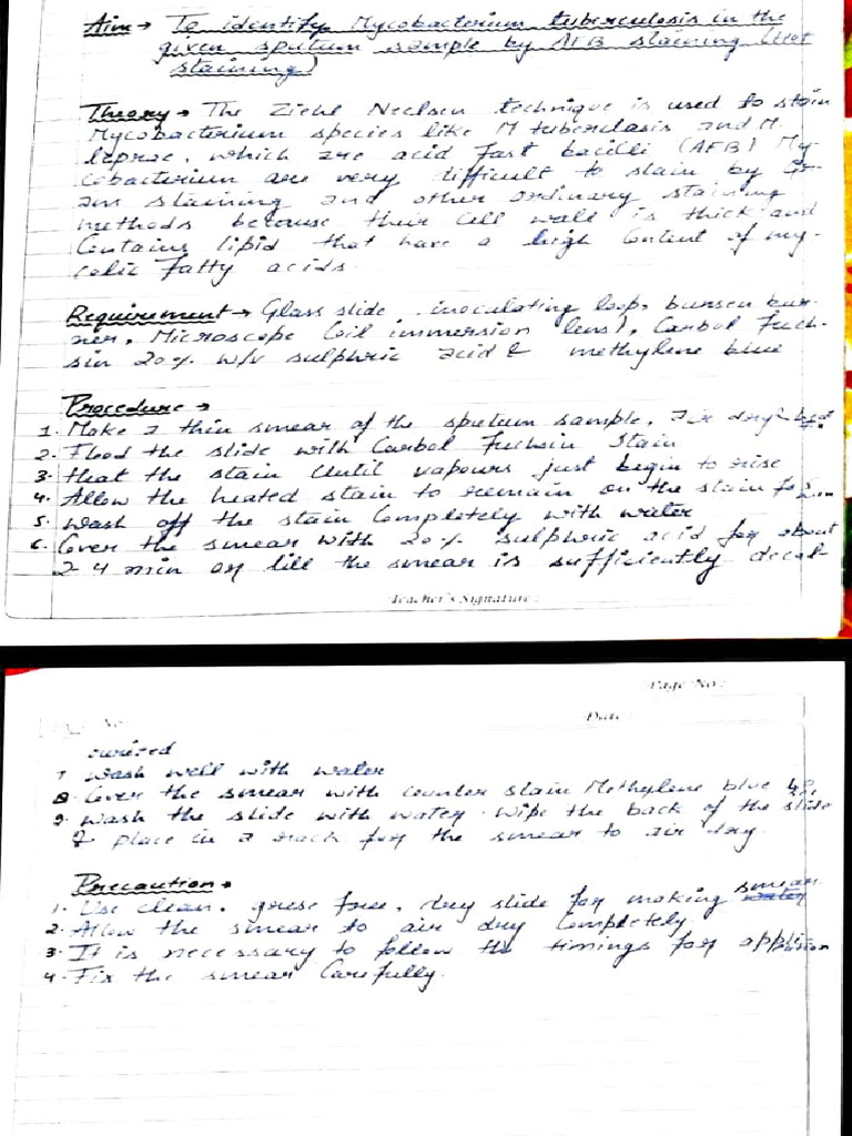 ZN Stain With Diagram | PDF